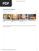 AAFP Dizziness - Evaluation and Management | PDF | Vertigo | Ménière's ...