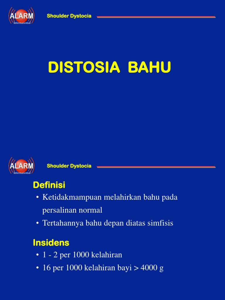 Panduan Distosia Bahu untuk Medis | PDF