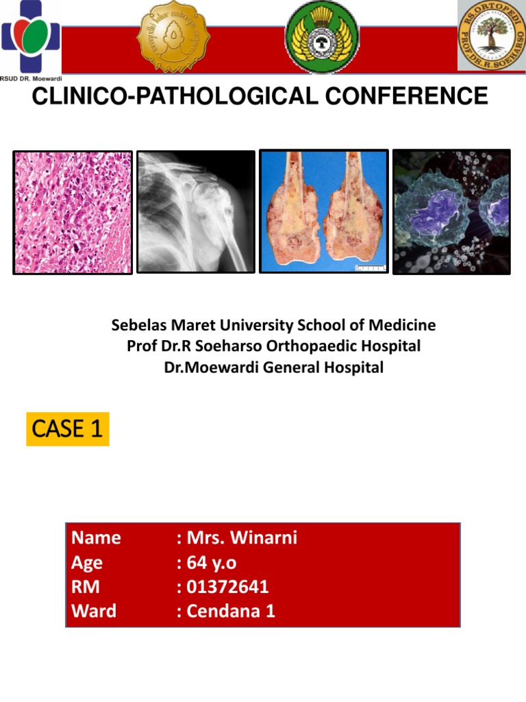 Clinico-Pathological Conference | PDF | Neoplasms | Pain