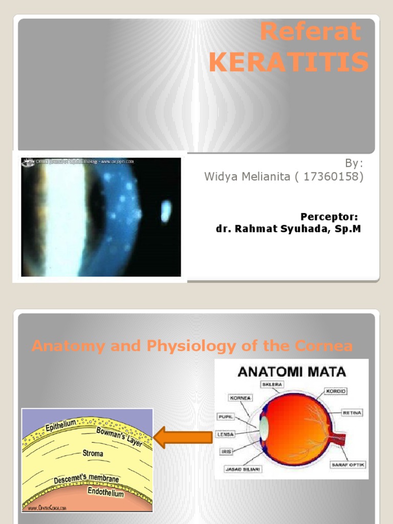 Keratitis: Causes and Treatments | PDF | Cornea | Human Eye