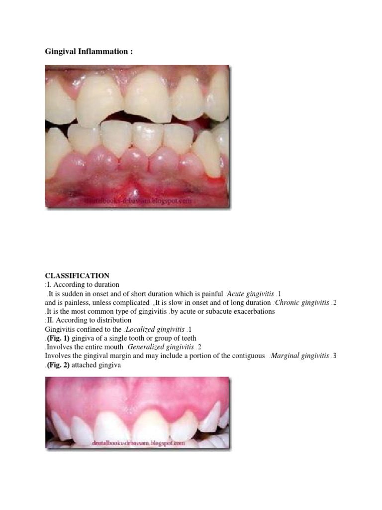 Gingival Inflammation | Mouth | Animal Anatomy