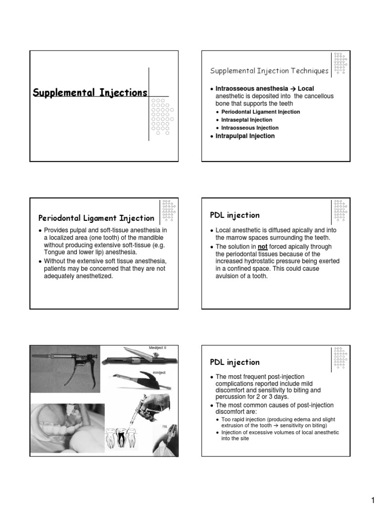 Supplemental Injections: Periodontal Ligament Injection PDL Injection ...