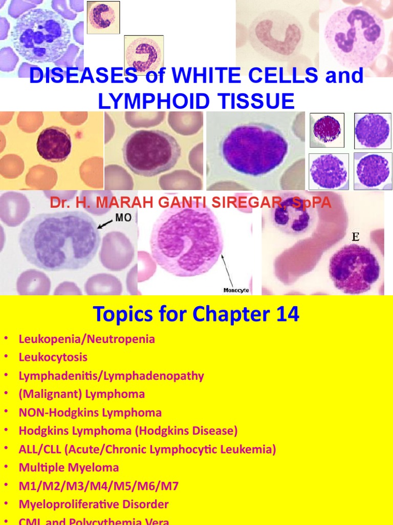 Diseases of White Cells and Lymphoid Tissue: Dr. H. Marah Ganti Siregar ...