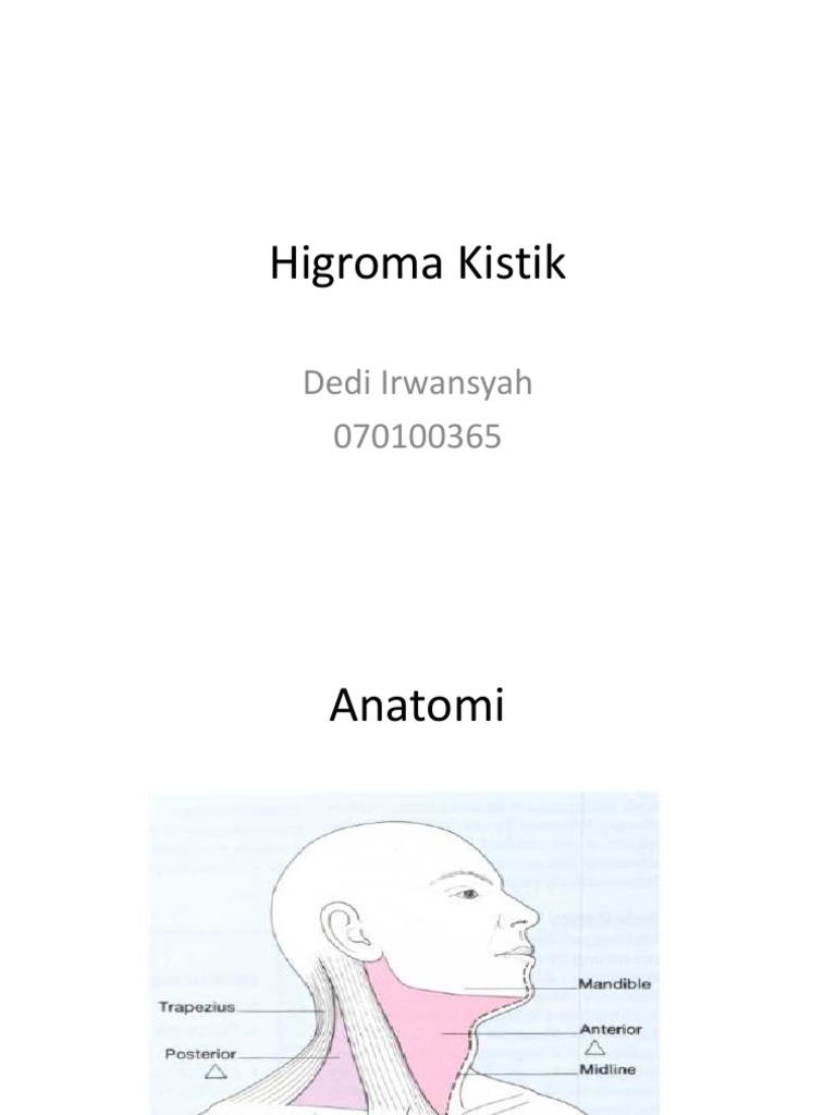 Higroma Kistik | PDF