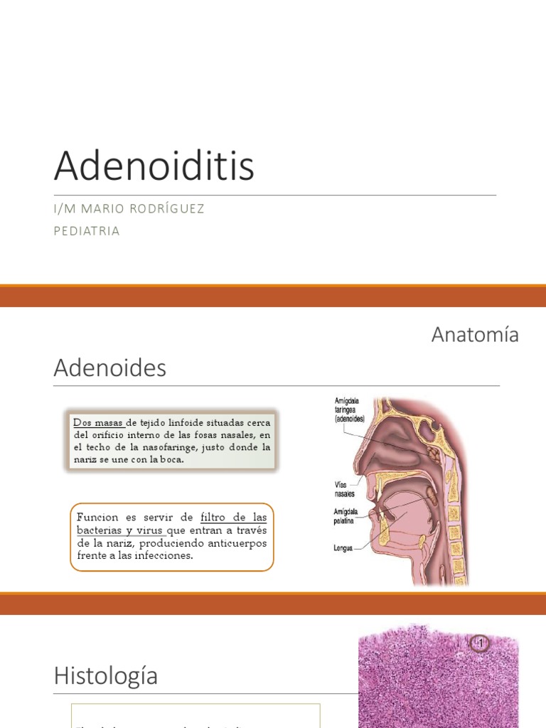 Adenoiditis: Causas, Síntomas y Tratamiento | PDF | Epitelio | Apnea ...