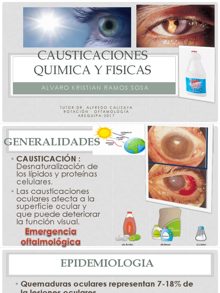Causticaciones Quimica y Fisicas | PDF | Quemar | Ojo humano