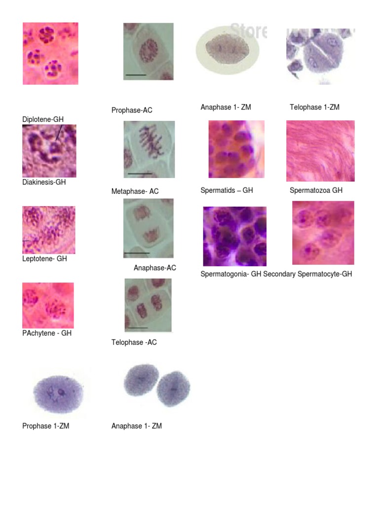 Prophase-AC Diplotene-GH Anaphase 1-ZM Telophase 1-ZM | PDF