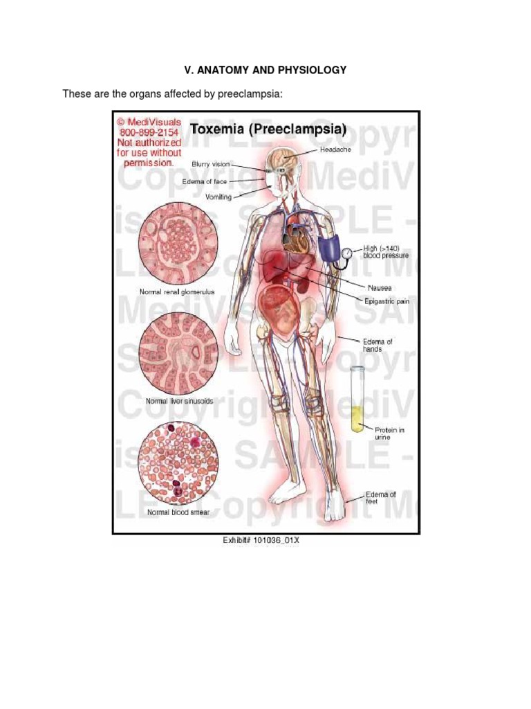 Anatomy Pathophysiology Preeclampsia | PDF | Animal Anatomy | Biology
