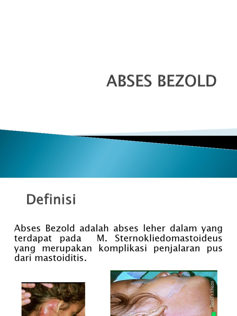 Abses Bezold | PDF | Sains & Matematika