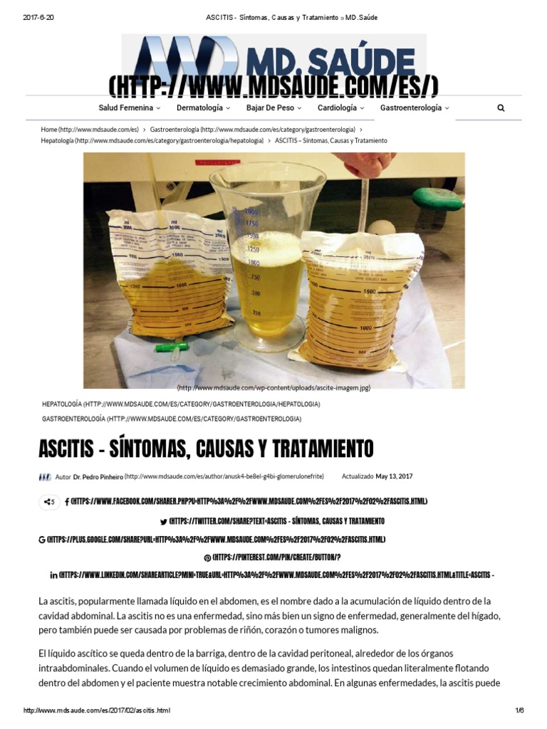 ASCITIS - Síntomas, Causas y Tratamiento » MD | Cirrosis ...