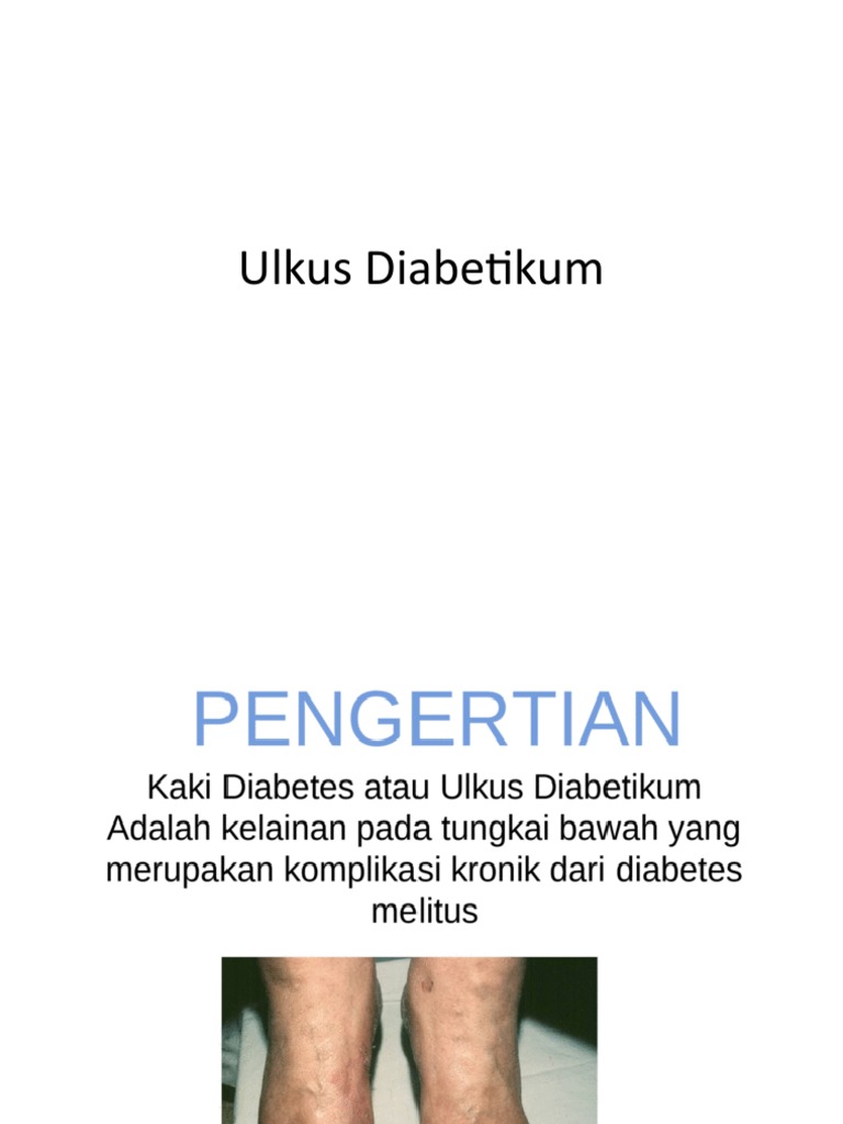 Ulkus Diabetikum | PDF
