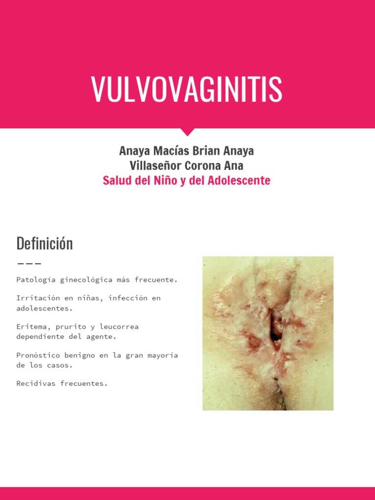 Vulvo Vaginitis | PDF | Especialidades Medicas | Enfermedades y trastornos