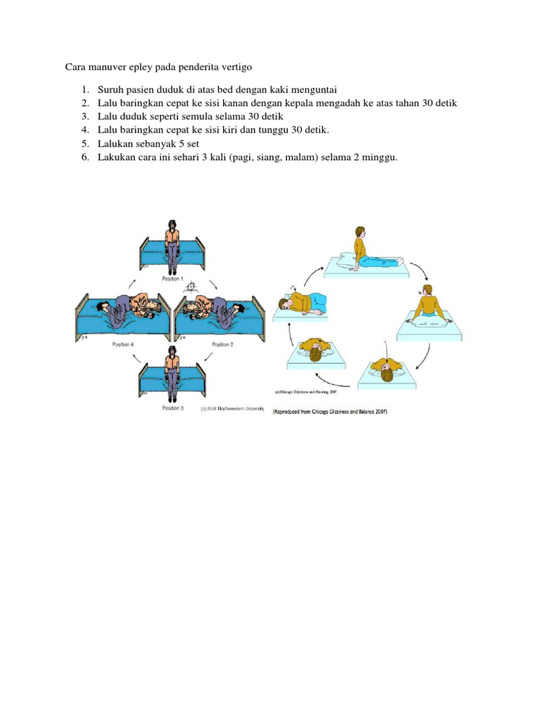 Cara Manuver Epley Pada Penderita Vertigo | PDF