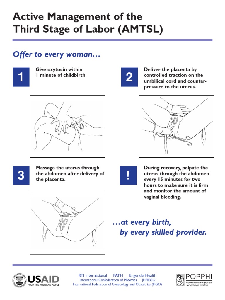 Active Manag. 3rd Stage Labor | PDF