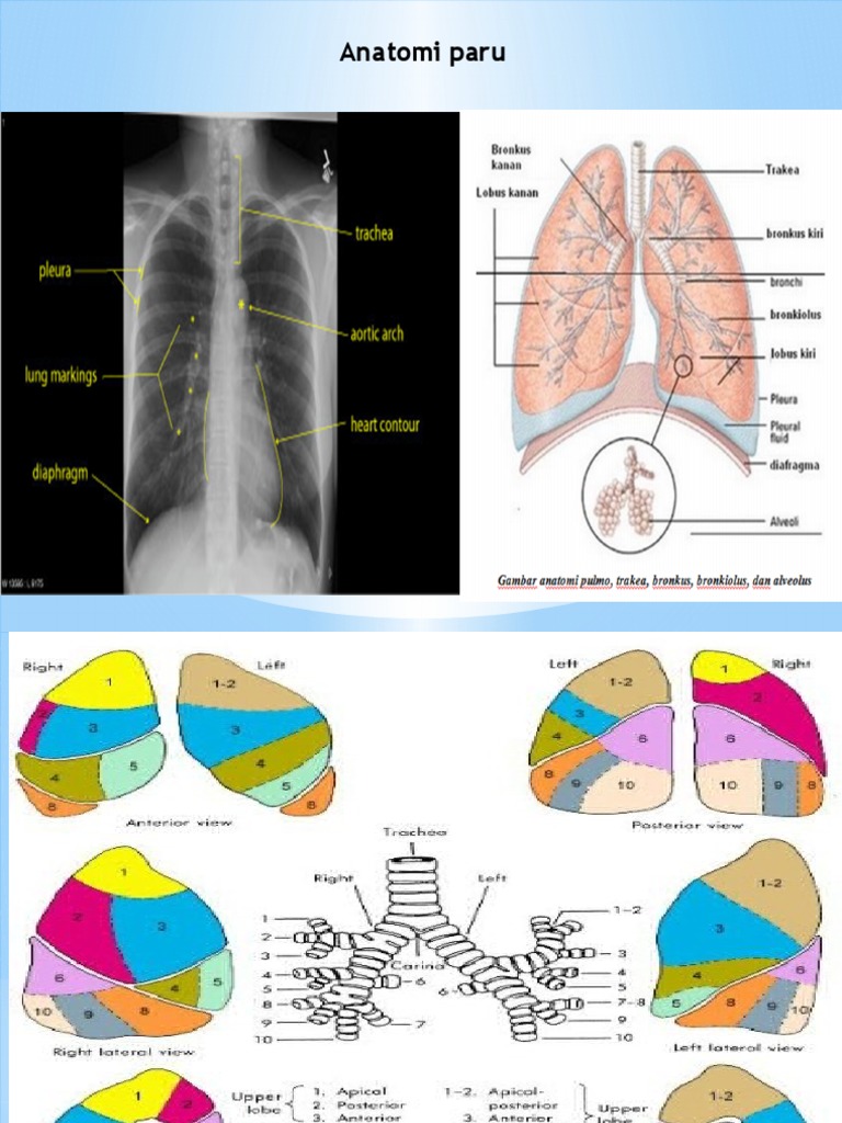 Anatomi Paru Dan Pneumonia | PDF