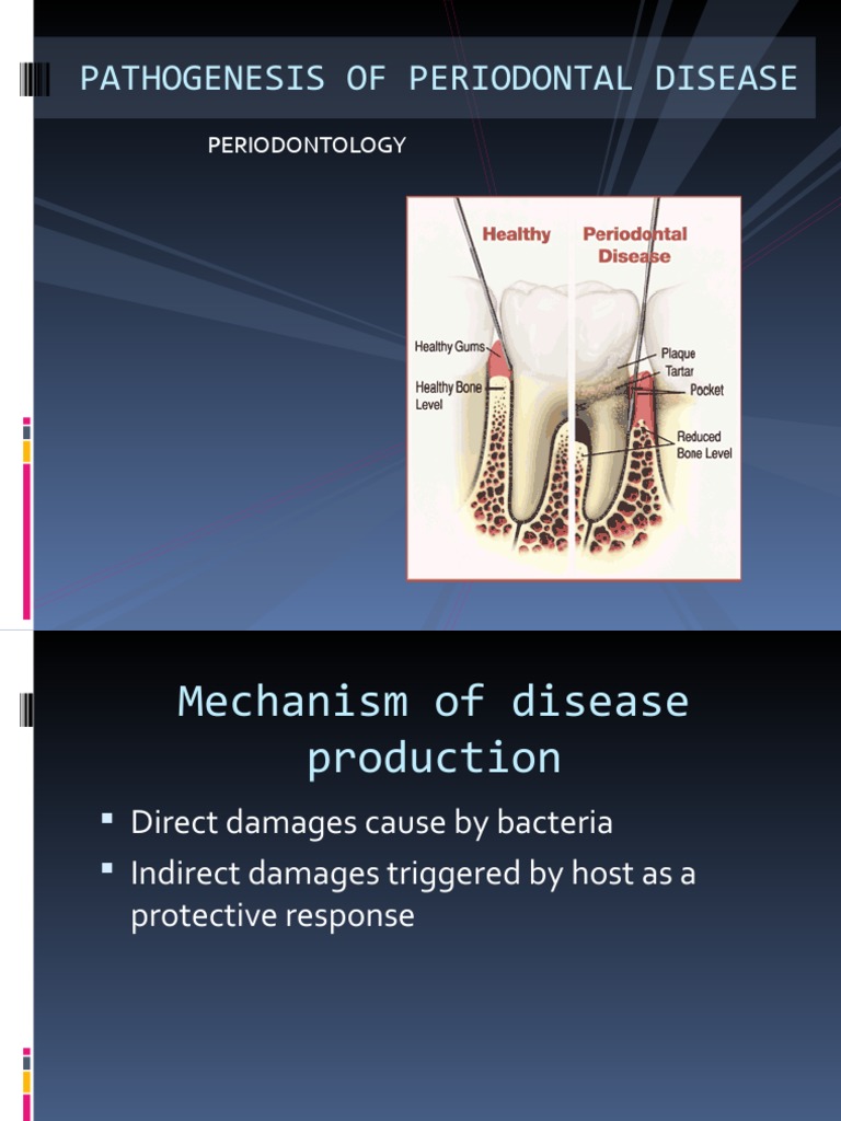 PathoGenesis of Periodontal Disease | PDF | Medical Specialties ...