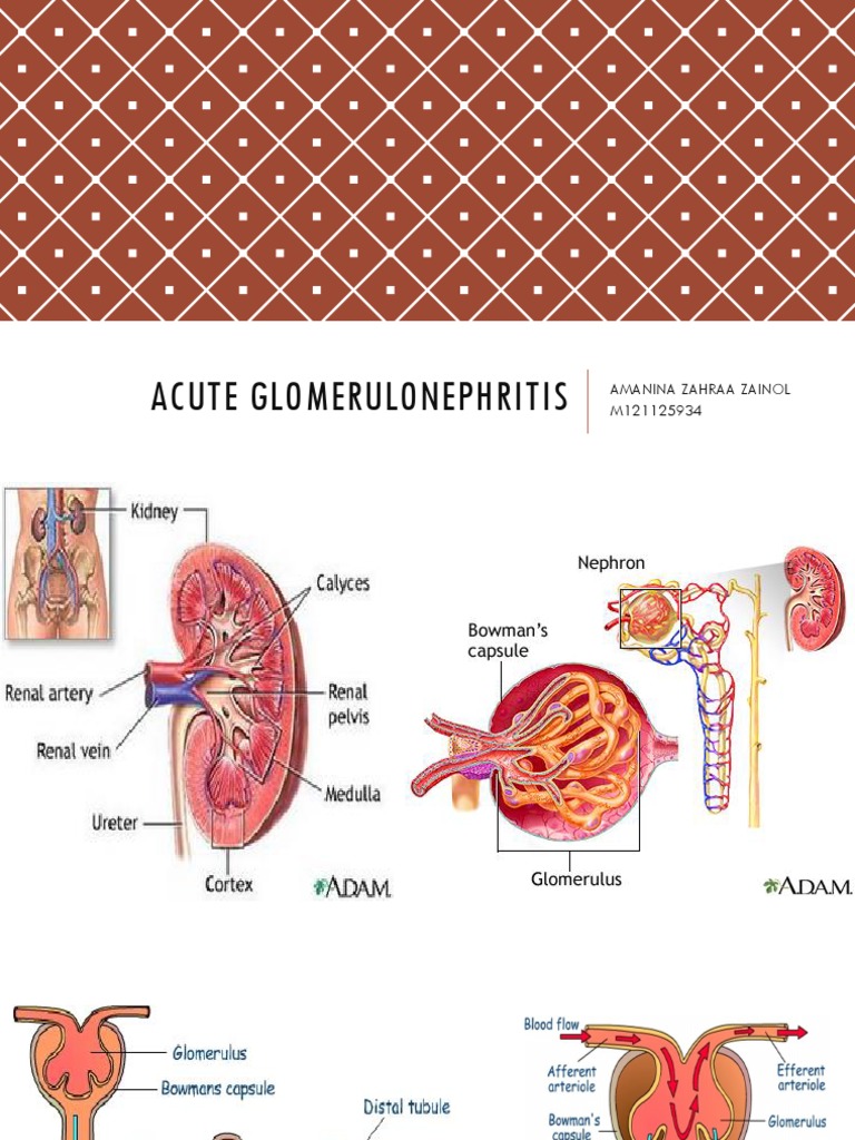 Acute Glomerulonephritis | Medical Specialties | Diseases And Disorders