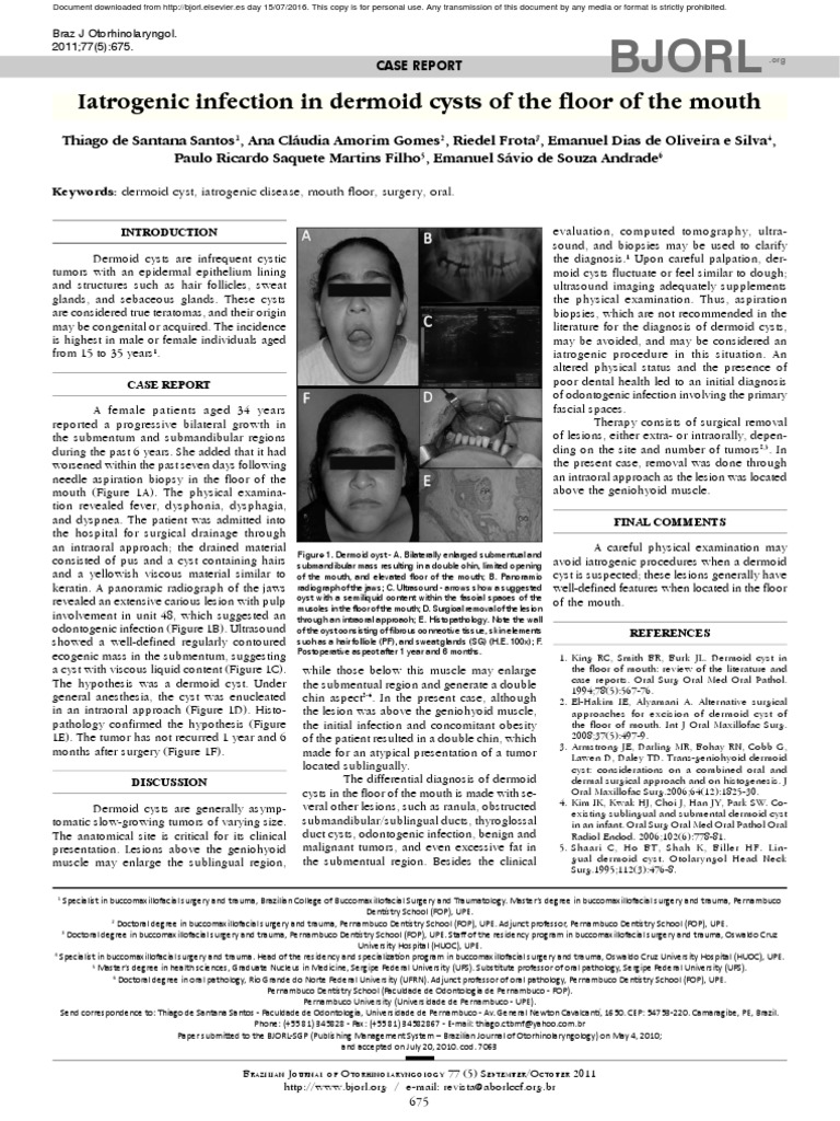 Dermoid Cysts Of The Floor Of The Mouth Case Report And Literature