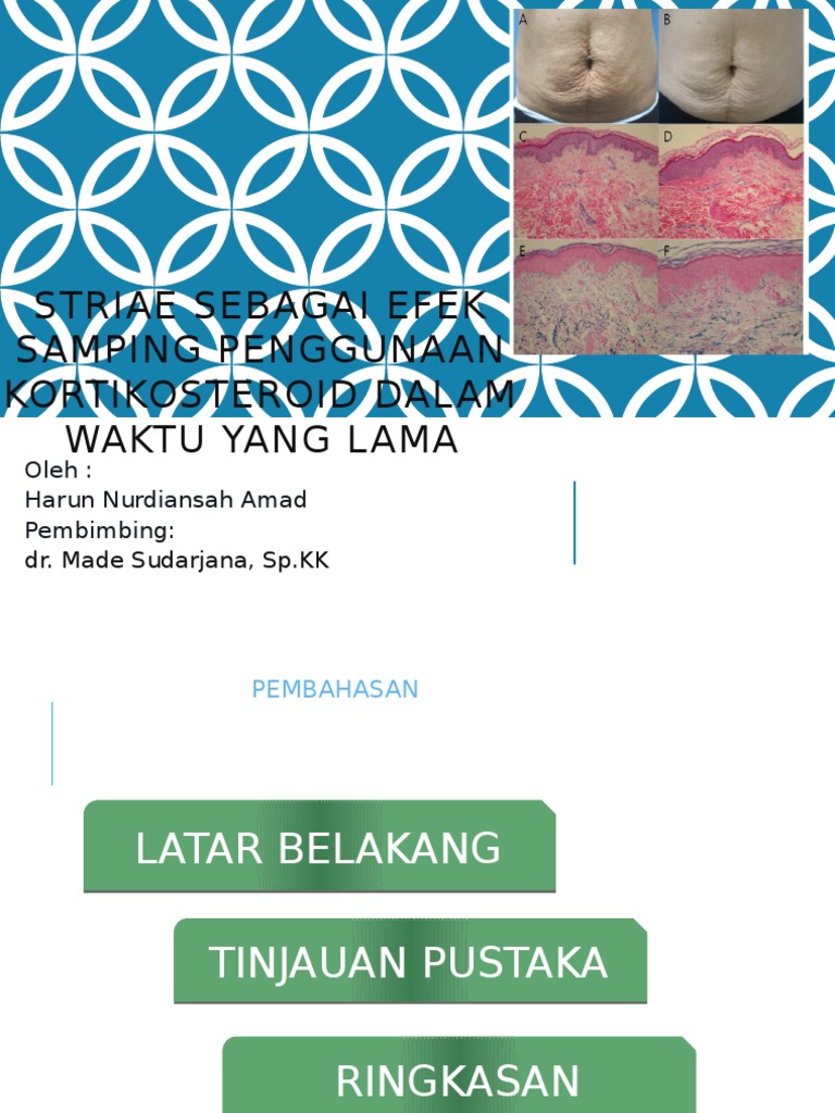 Refleksi Kasus - Striae | PDF