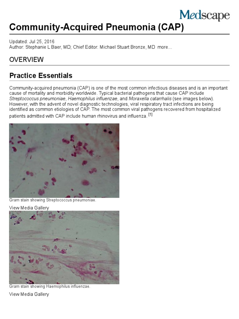 Community-Acquired Pneumonia (CAP) : Practice Essentials, Overview ...
