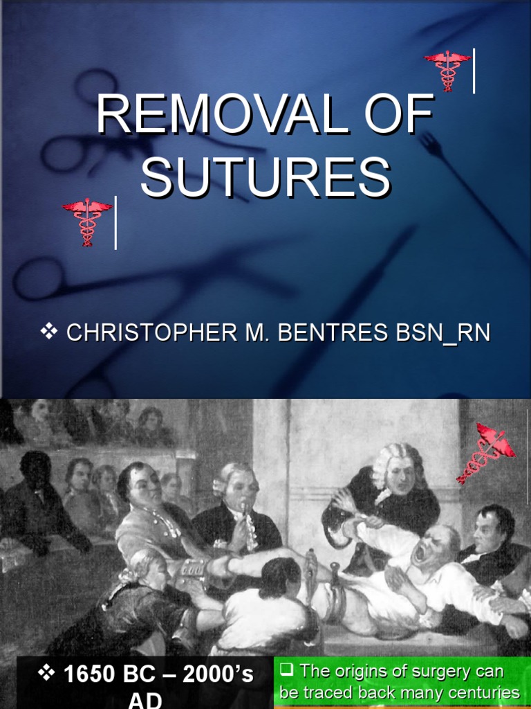Removal of Suture | PDF | Surgical Suture | Medicine