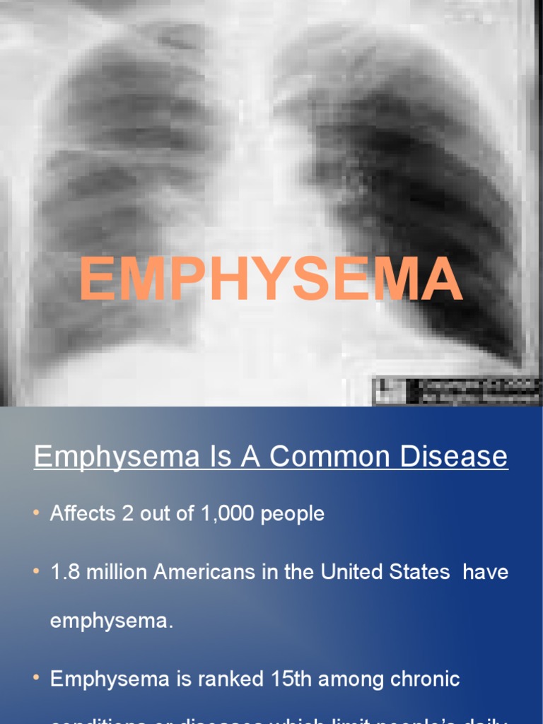 Emphysema | PDF | Lung | Chronic Obstructive Pulmonary Disease