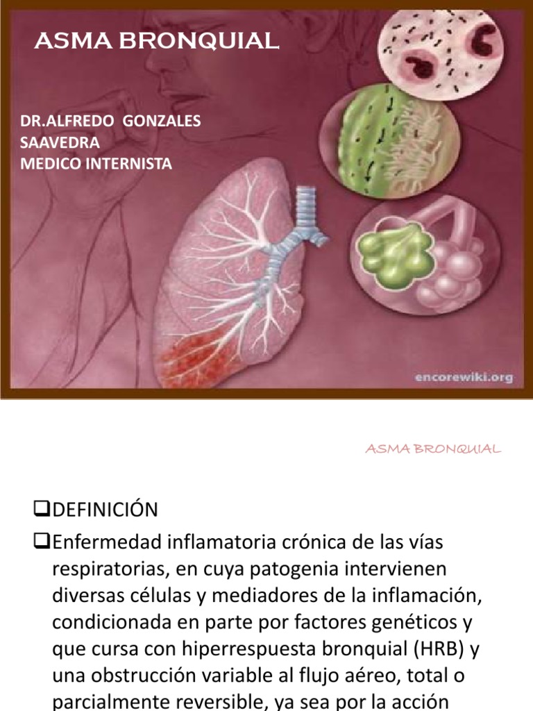 ASMA BRONQUIAL EXPOSICION.pptx | Asma | Tos