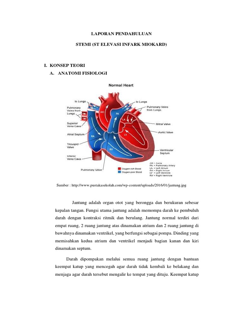Laporan Pendahuluan Stemi | PDF