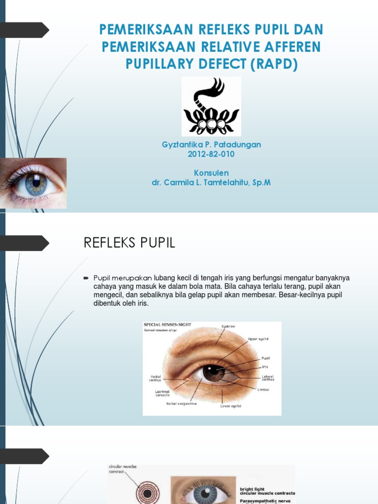 Pemeriksaan Refleks Pupil Dan Pemeriksaan Relative Afferen Pupillary | PDF