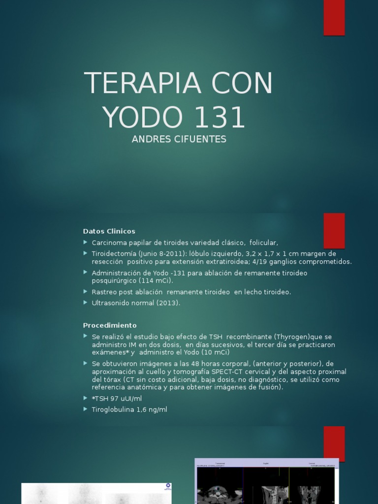 Terapia con yodo 131: documento técnico sobre el procedimiento y preparación | PDF | Tiroides ...