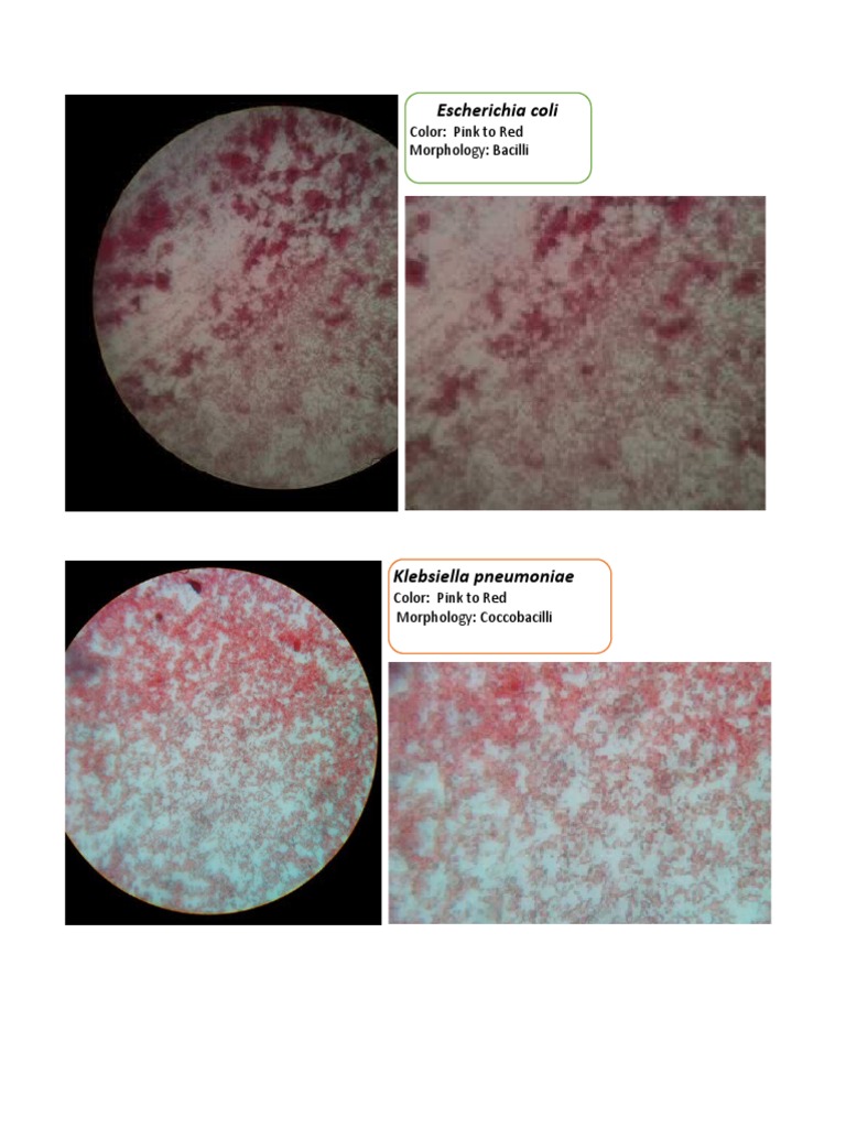 E. coli Morphology and Color Details | PDF