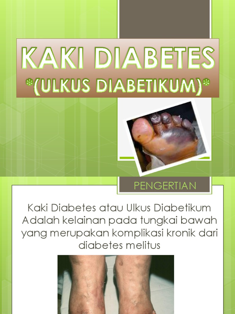Ulkus Diabetikum | PDF