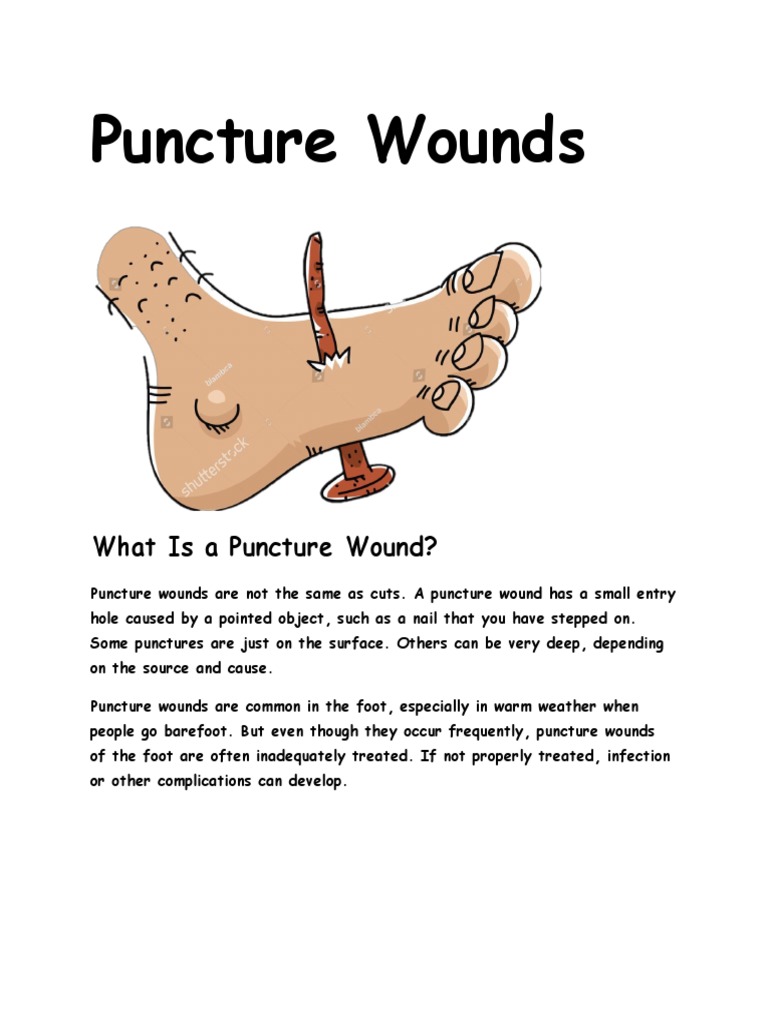 Puncture Wound Nail