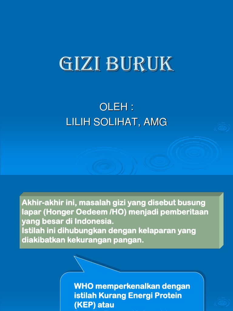 Materi Gizi Buruk | PDF