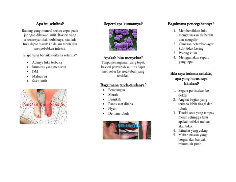 Leaflet Selulitis PKK 5 | PDF
