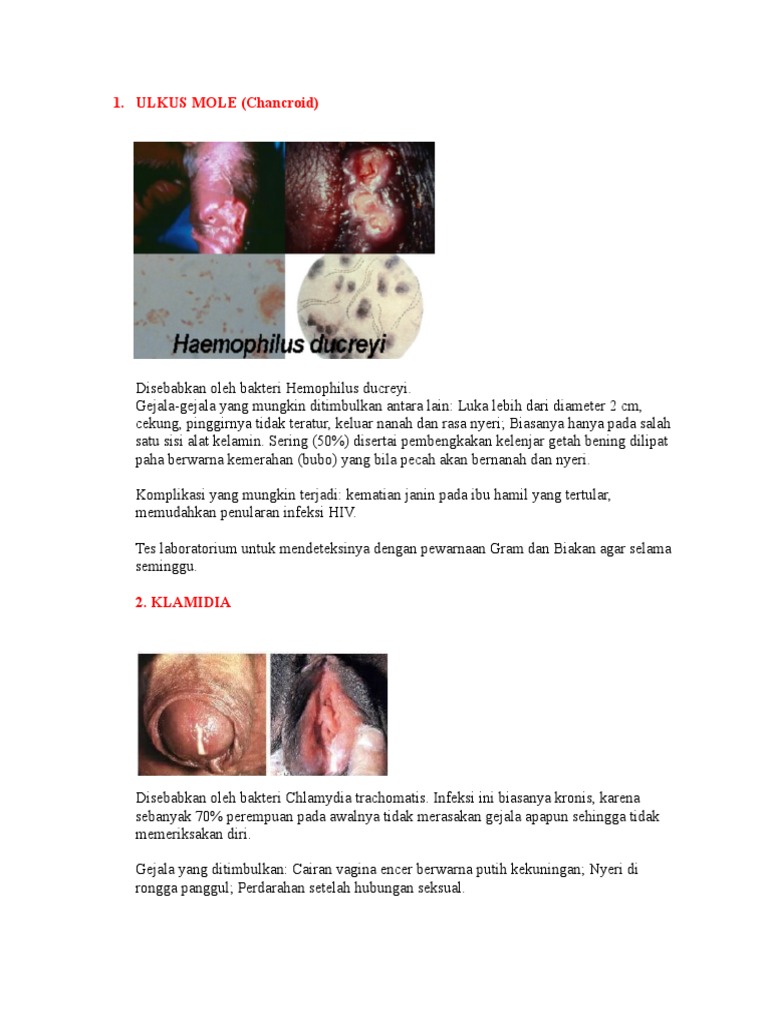 ULKUS MOLE (Chancroid) | PDF