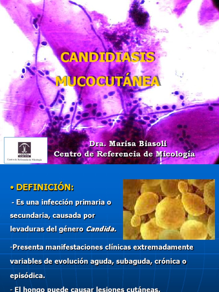 Candidiasis Mucocutaneas PW | PDF | Candidiasis | Candida (hongo)