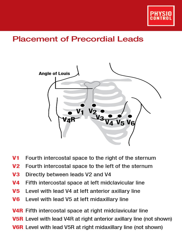 Precordial Leads Placement Card 3304235.A PDF | PDF