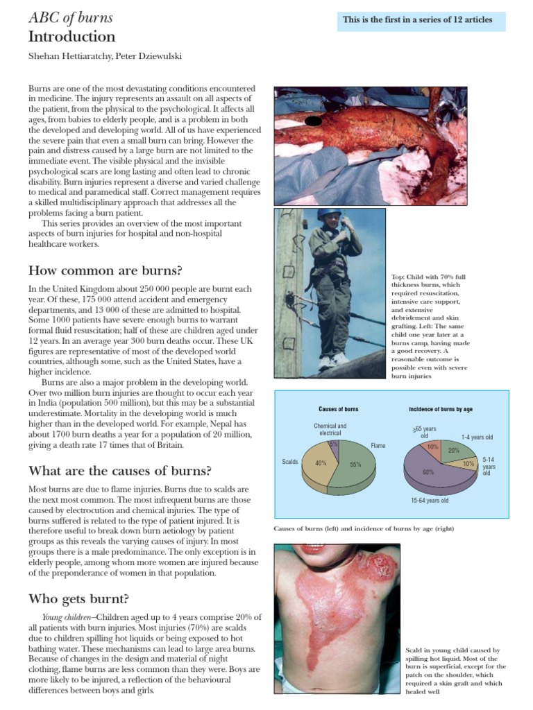 ABC of Burns PDF | PDF | Burn | High Voltage