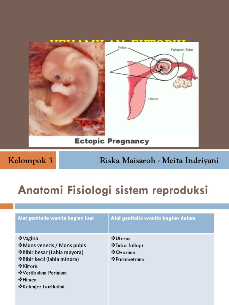 Kehamilan Ektopik Terganggu | PDF