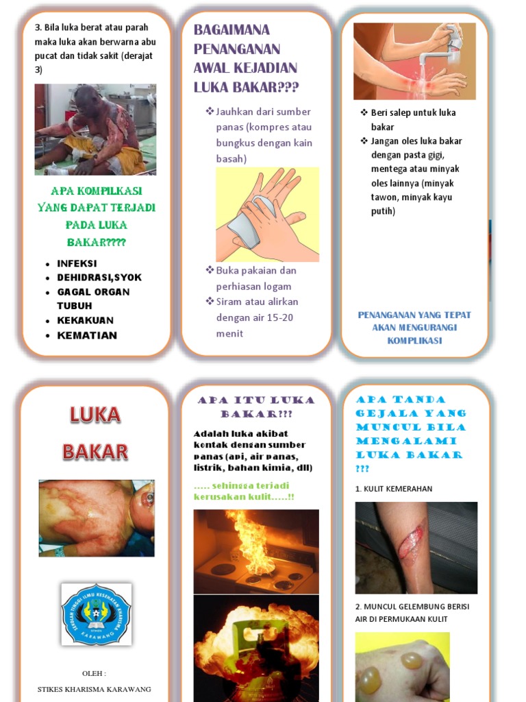 Leaflet Penanganan Luka Bakar | PDF
