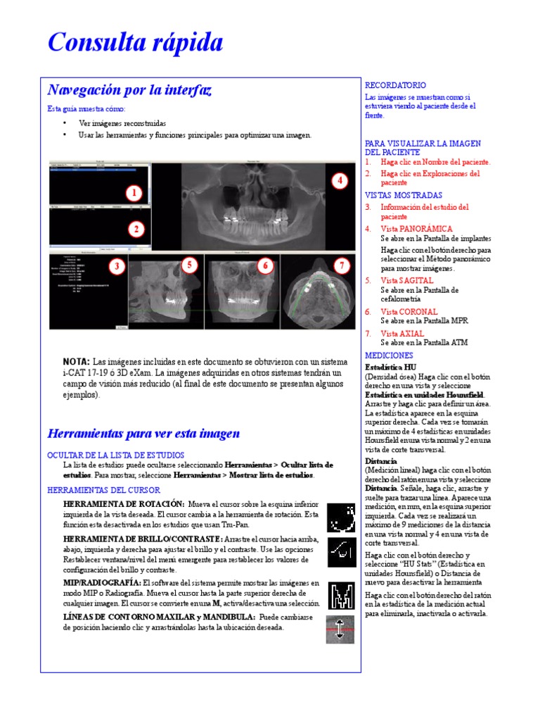 Manual ICat Vision | Point and Click | Ventana (informática)