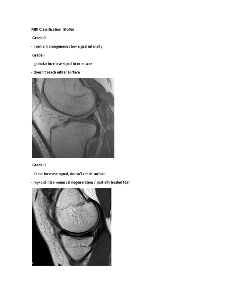 MRI Classification | PDF