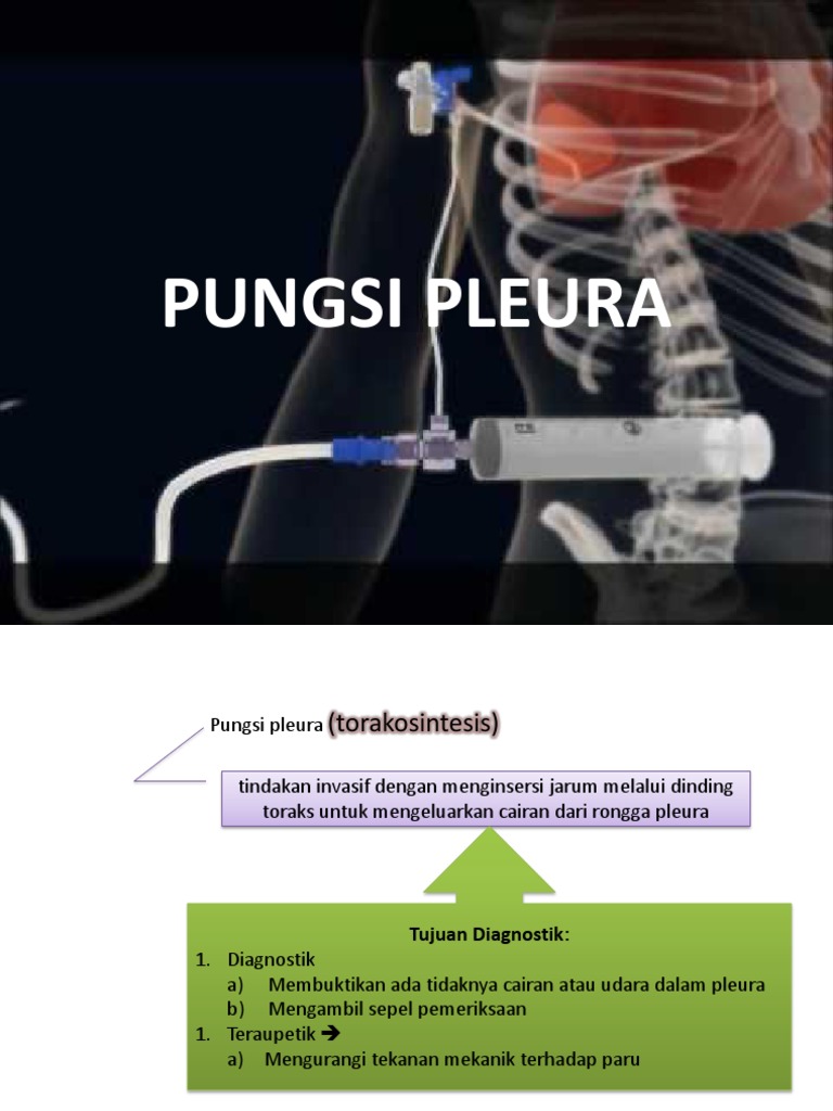 Pungsi Pleura | PDF