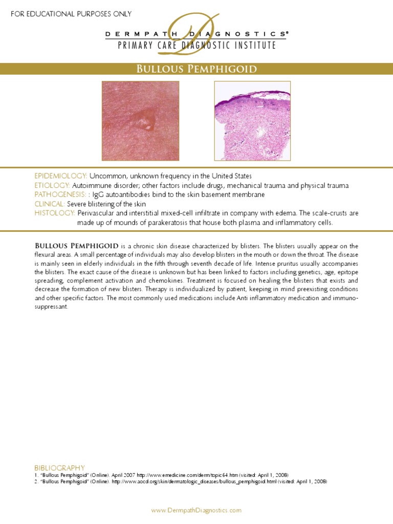 Bullous Pemphigoid: Primary Care Diagnostic Institute | PDF