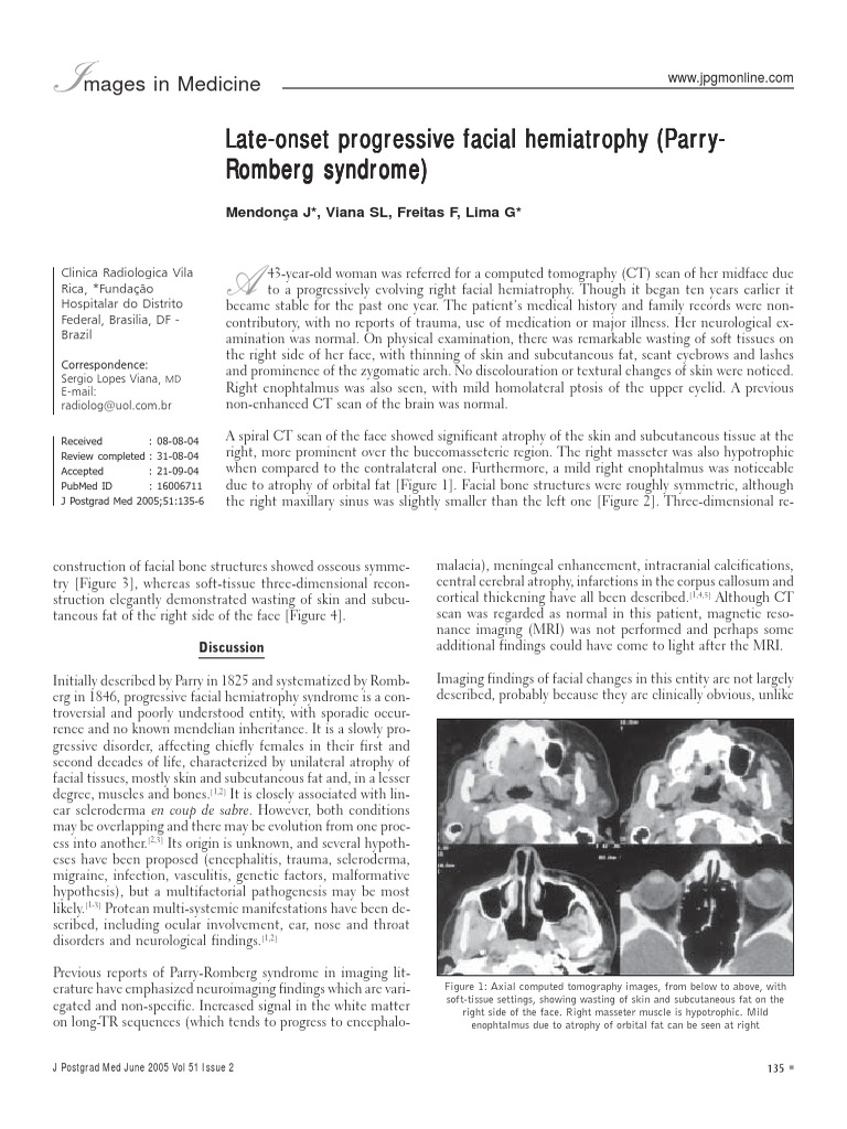 Late Onset Progressive | Download Free PDF | Anatomy | Medical Specialties