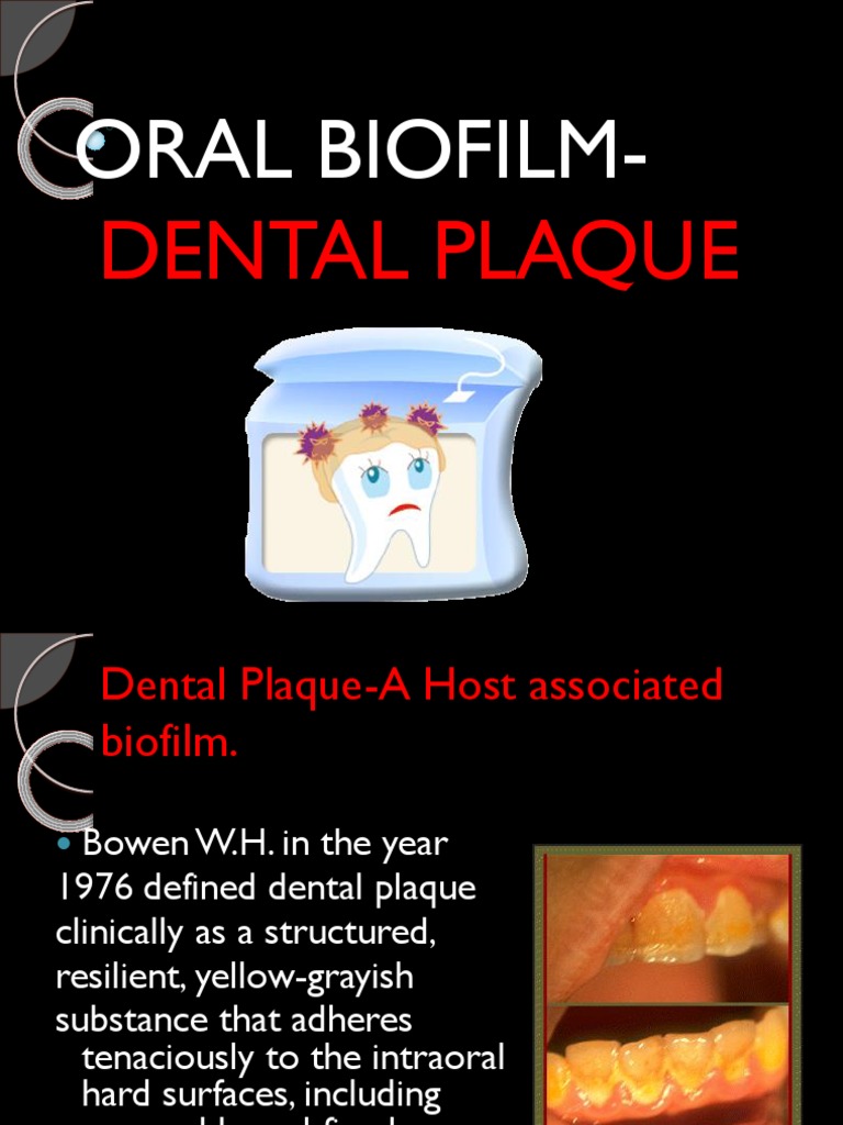 Oral Biofilm-: Dental Plaque | PDF | Biofilm | Bacteria