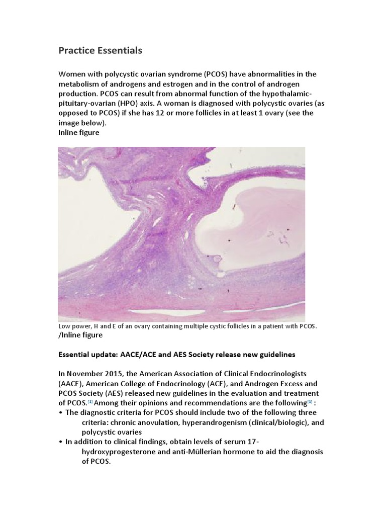 Polycystic Ovarian Syndrome | PDF