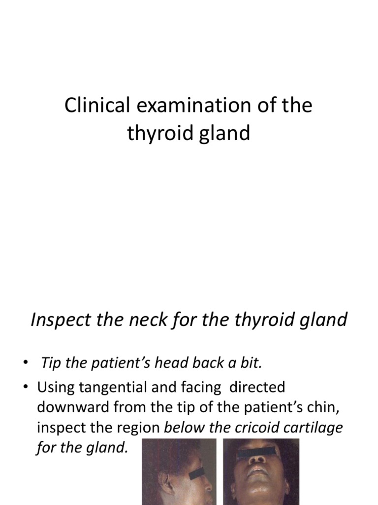 Clinical Exam Thyroid Pdf Neck Thyroid