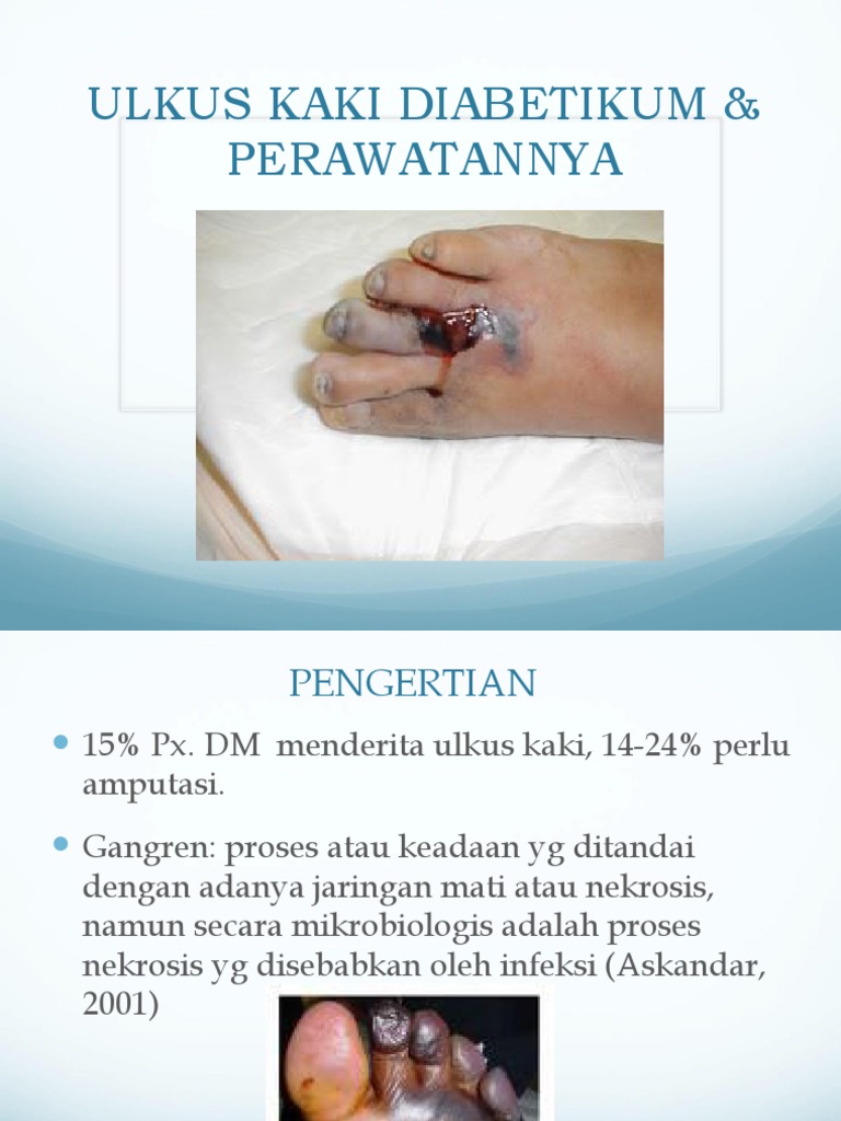 Ulkus Diabet | PDF | Politik